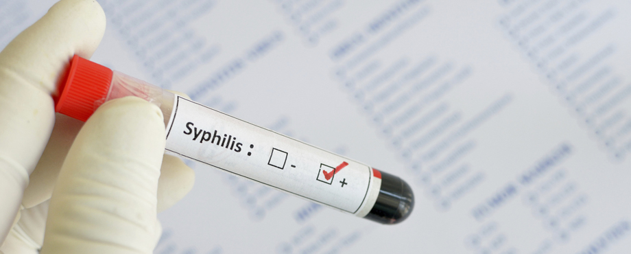 Report: Syphilis on the Rise